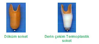 Physical Disability Treatment: Socket Types Used in Denture Prosthesis