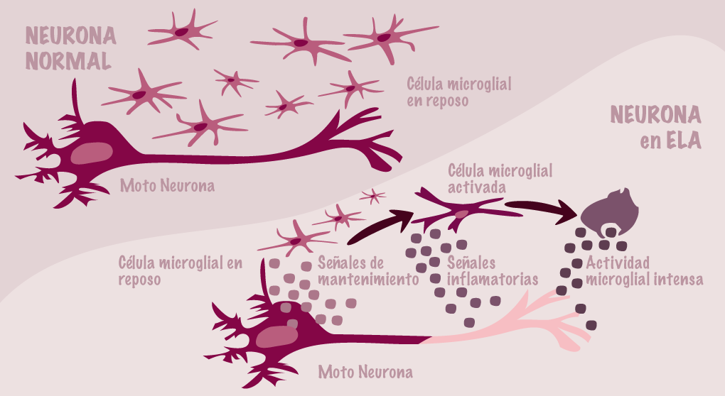 Exposición sobre Investigación sobre en Enfermendades Raras: Esclerosis ...