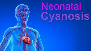 Traumagency: Approach To Neonatal CYANOSIS