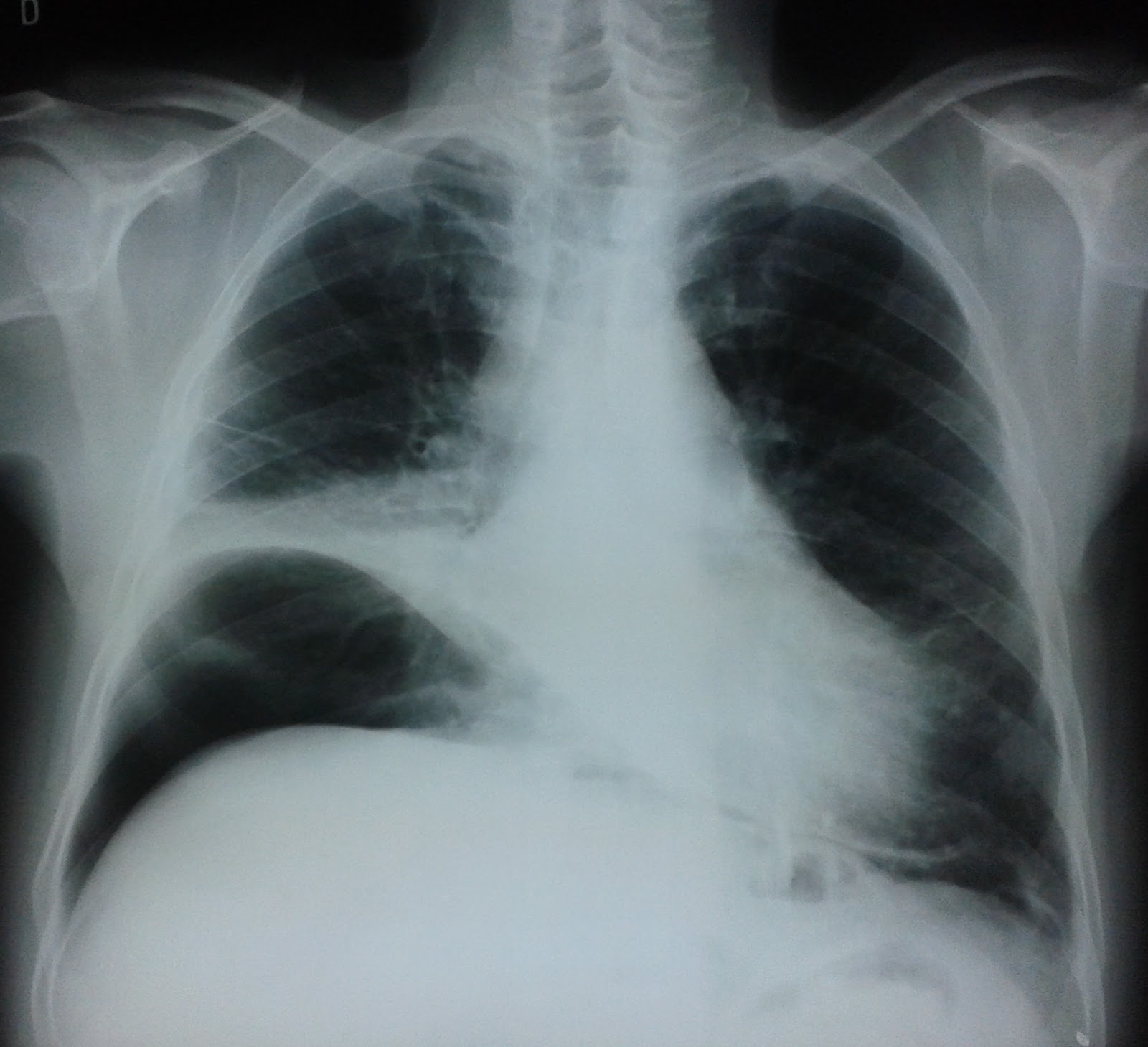 DICAS DE RADIOLOGIA - Tudo Sobre Radiologia: IMAGENS RADIOLÓGICAS ...