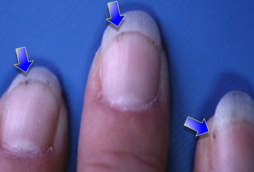 World's Tragic In Medlife,.....You May Know Or Not