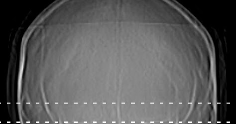 Blogged Up Body - Blogged Up Life : Radiology