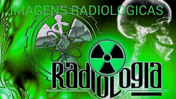 Imagens Radiológicas: Simbolo da radiologia