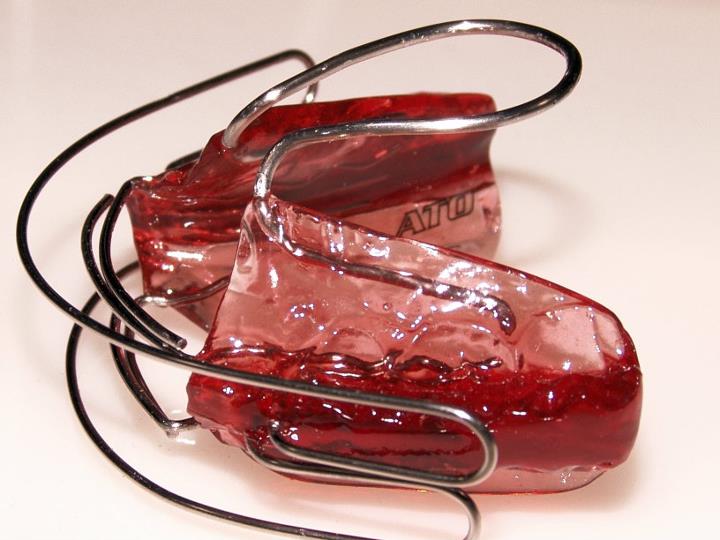 Ortopedia Funcional de los Maxilares: …APRÉNDELO TODO SOBRE EL APARATO ...