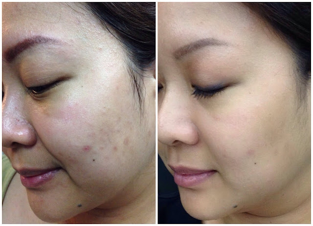 Bosan Dengan Wajah Kusam? Cerahkan Dengan Bahan Alami Ini, Dan Lihat ...