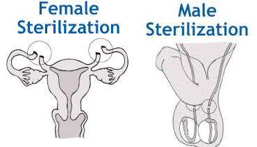 Birth Control Guide - Female and Male Sterilization - HEALTH GUIDE 911