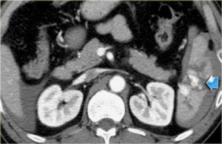 ECC EDUCATION: Monthly Online Case Presentation (MOC) November 2013 ...