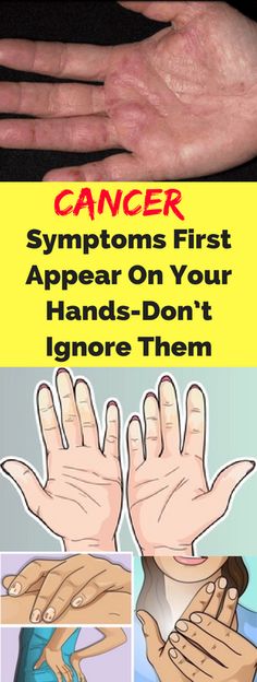 Cancer Symptoms First Appear On Your Hands-Don’t Ignore Them - HEALTH ...