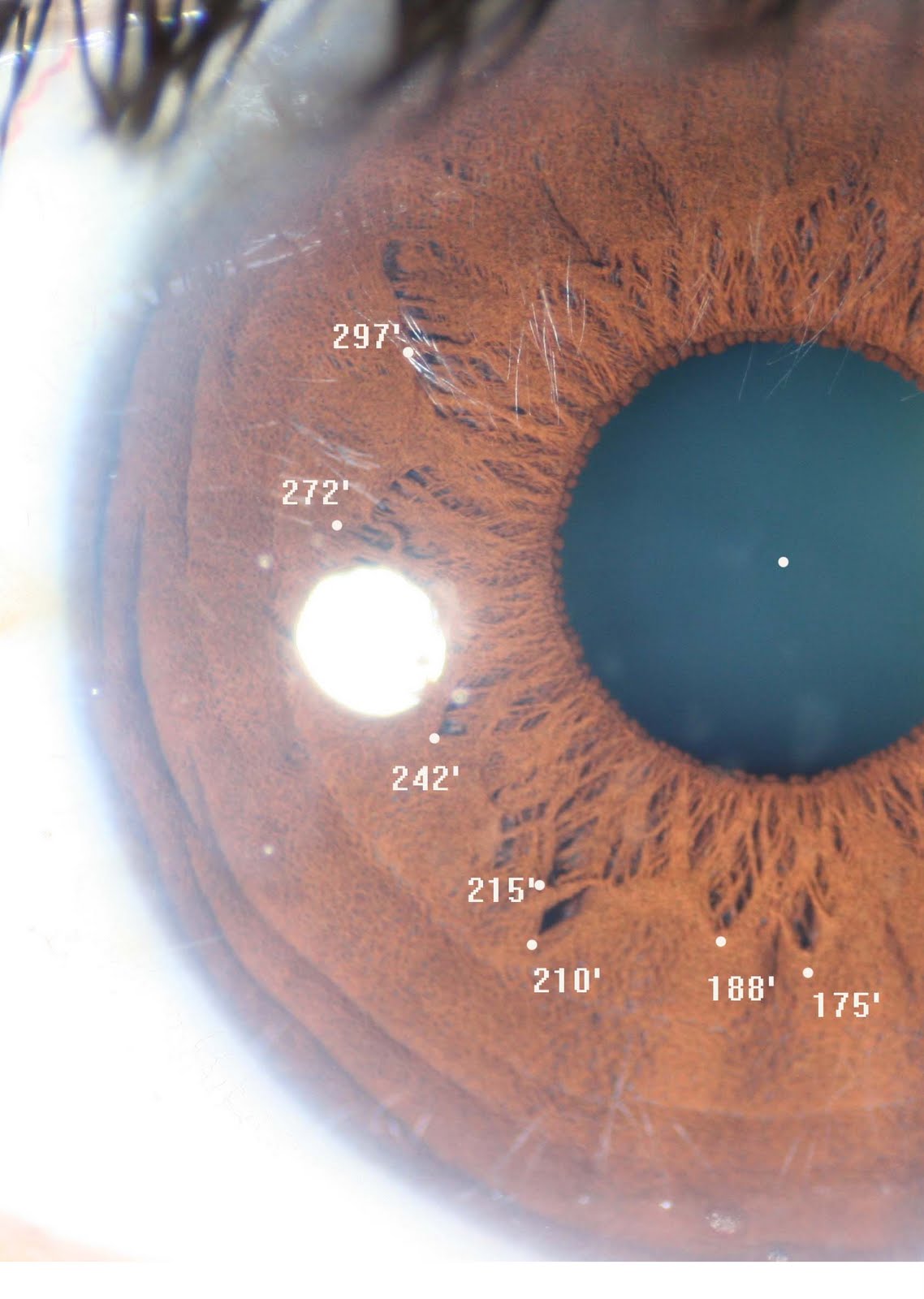 Modern & Multidimensional Iridology: Embryological Signs at Inner ...