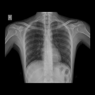 Radiography - The less favoured learning Topic, Yet essential - Sumer's ...