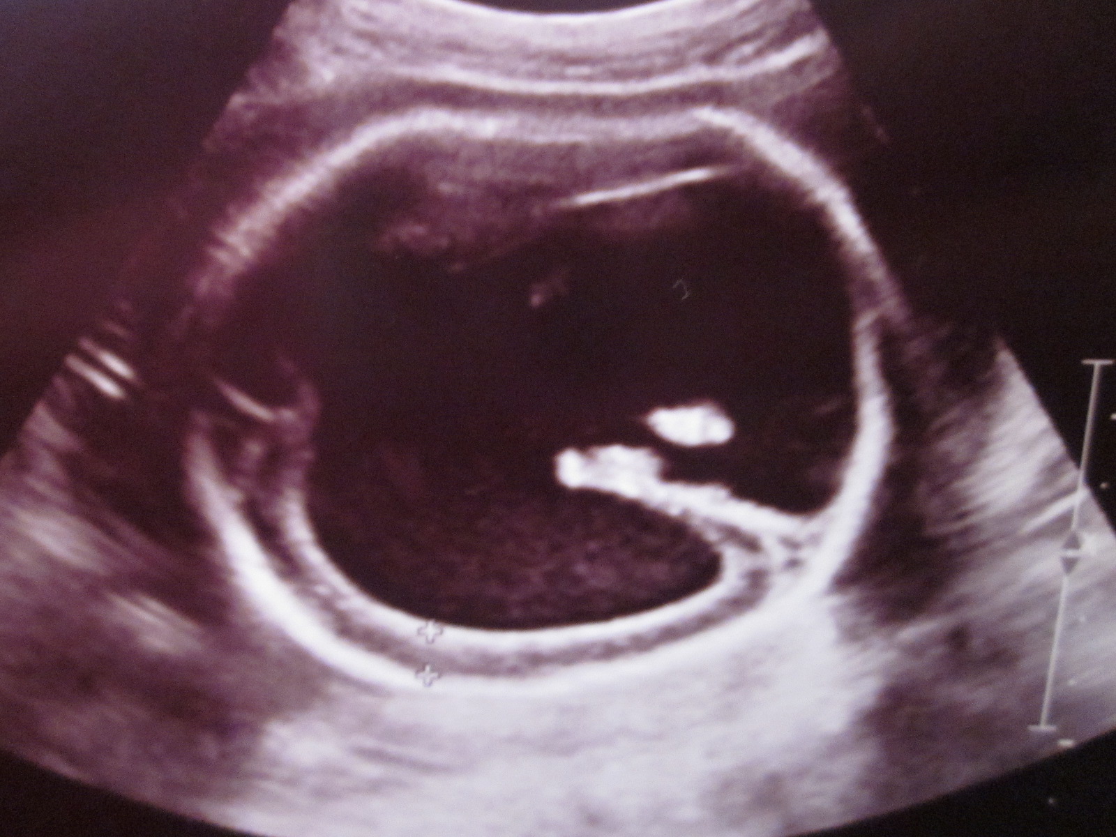 Meagan: Photos: 27 week ultrasound