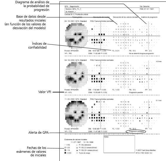 Interpretación Campo visual