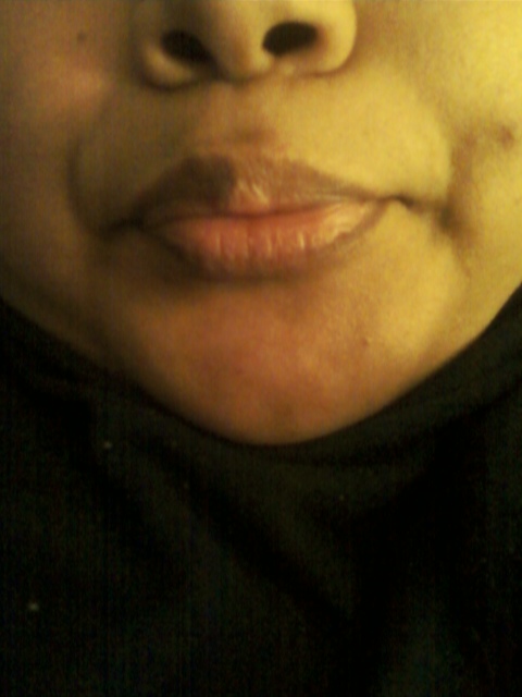 Living with Embouchure Dystonia: Embouchure Stretches / Lip Stretches ...