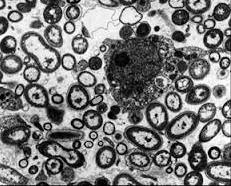 Cellular Totipotency - Botany | Biology Class 11