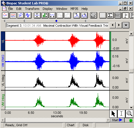 Muscular Biofeedback | Surface EMG