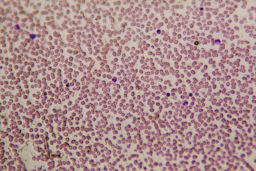 CUADERNO DE PRÁCTICAS HEMATOLOGÍA: Práctica: Tinción de Giemsa.