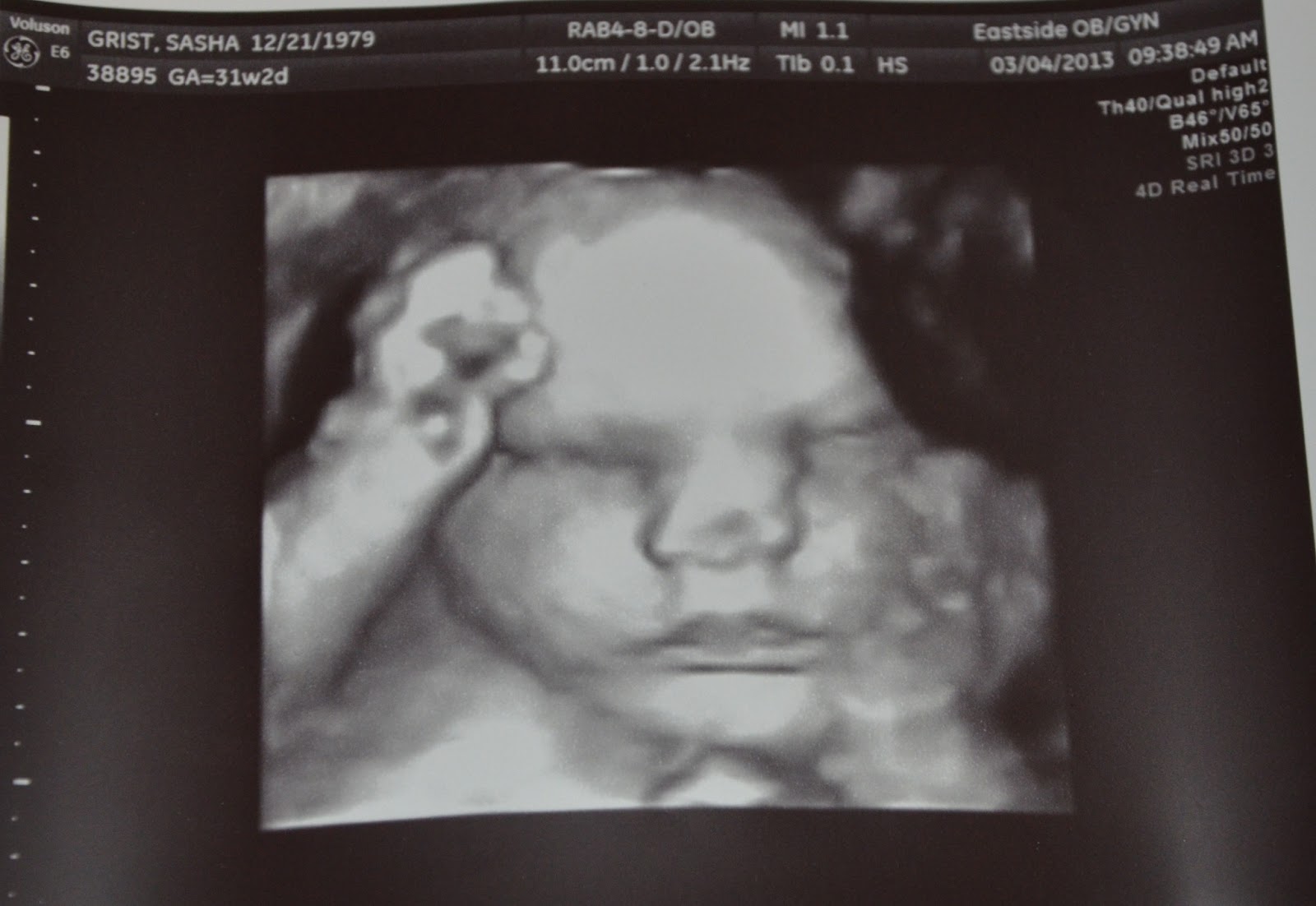 And Then There Were Five!: 31 Weeks Ultrasound