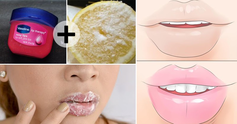 Want Pink And Smooth Lips Try These 10 Home Remedies And Achieve Pink Lips In No Time Style
