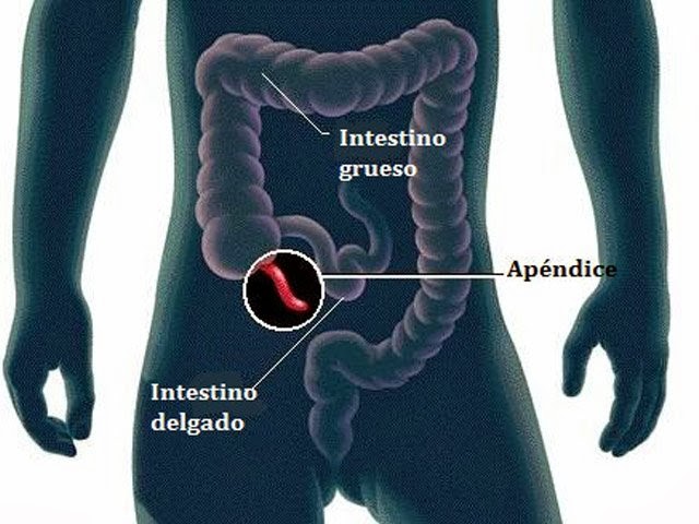 Apendicitis es más frecuente en niños - Salud en Casa Perú