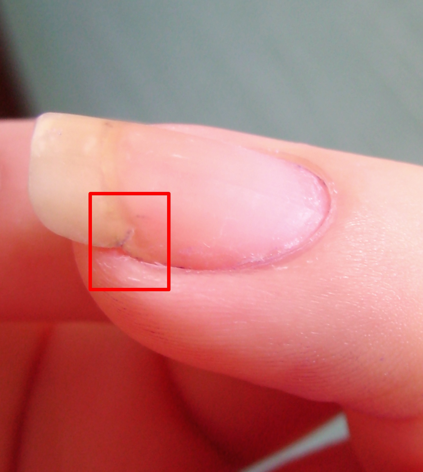 Tip fácil para arreglar uña quebrada ~ Belleza y Peinados