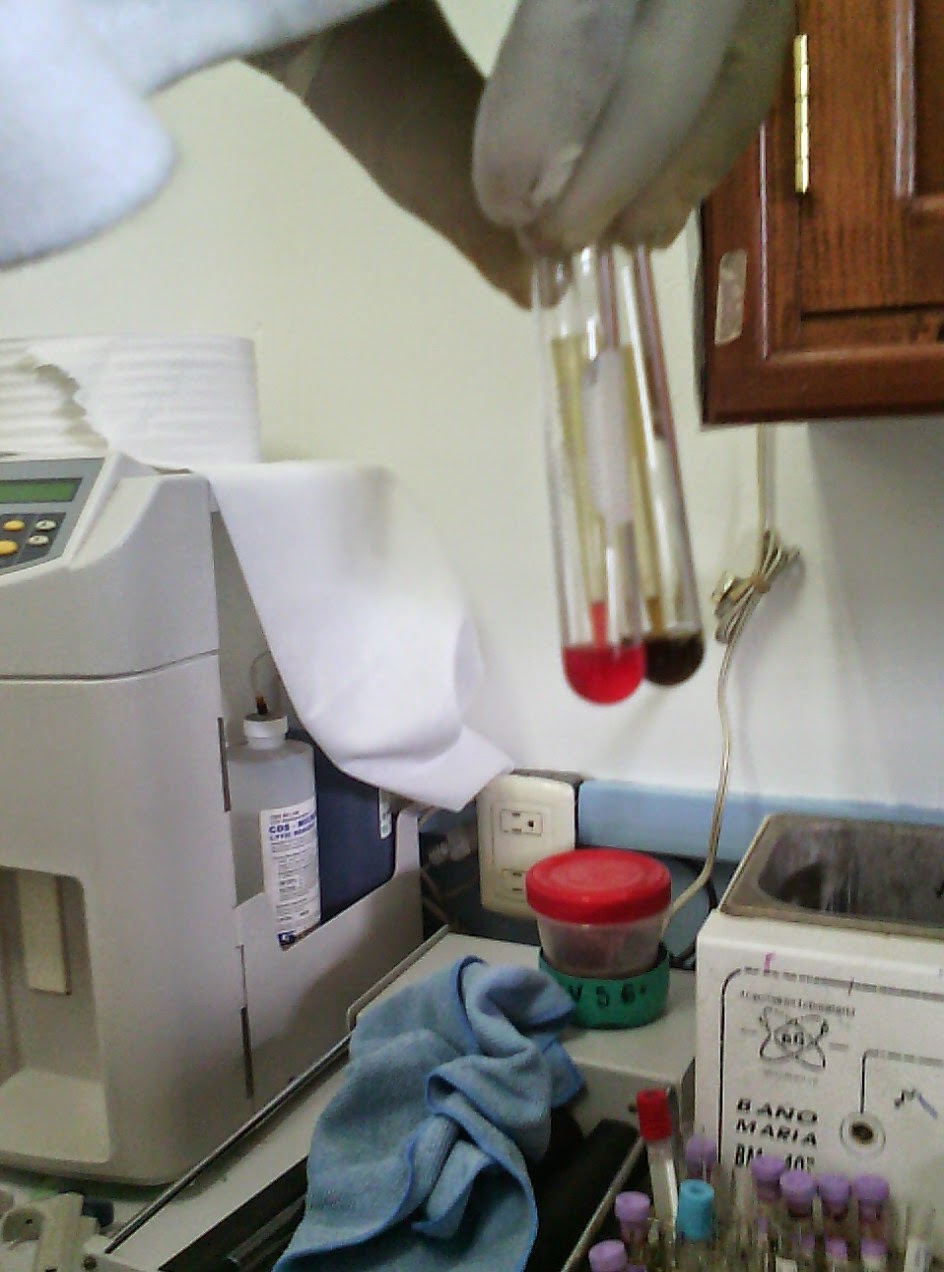 EQUIPO DE LABORATORIO CLINICO: EQUIPOS PARA UNA BIOMETRIA HEMATICA O ...