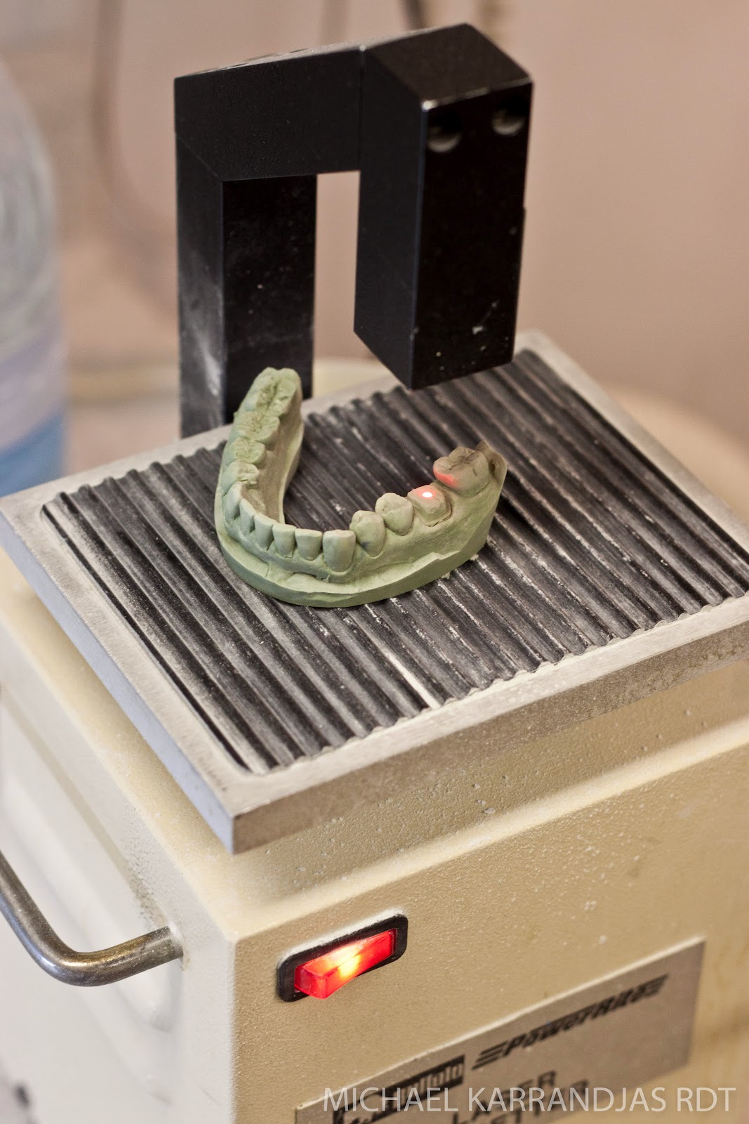 Dental Lab Model Fabrication | Making Noise And Drinking Beer