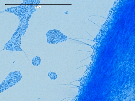 Fun With Microbiology (What's Buggin' You?)