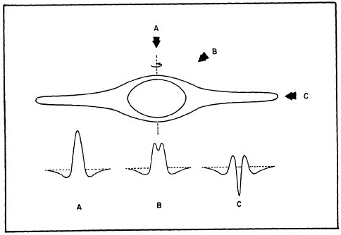 Observatoire de la belle étoile: Be stars spectroscopy - my current ...