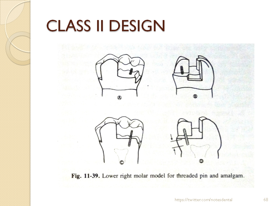 Dental Notes: Pin Retained Restorations NOTES