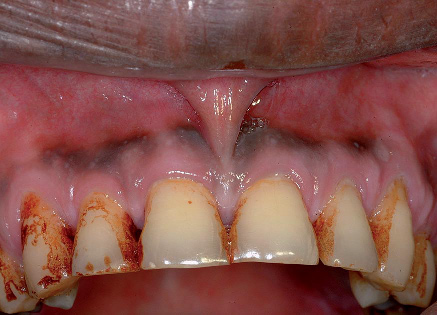 Dentistry and Medicine: Pigmentation and Discoloration of Oral and ...