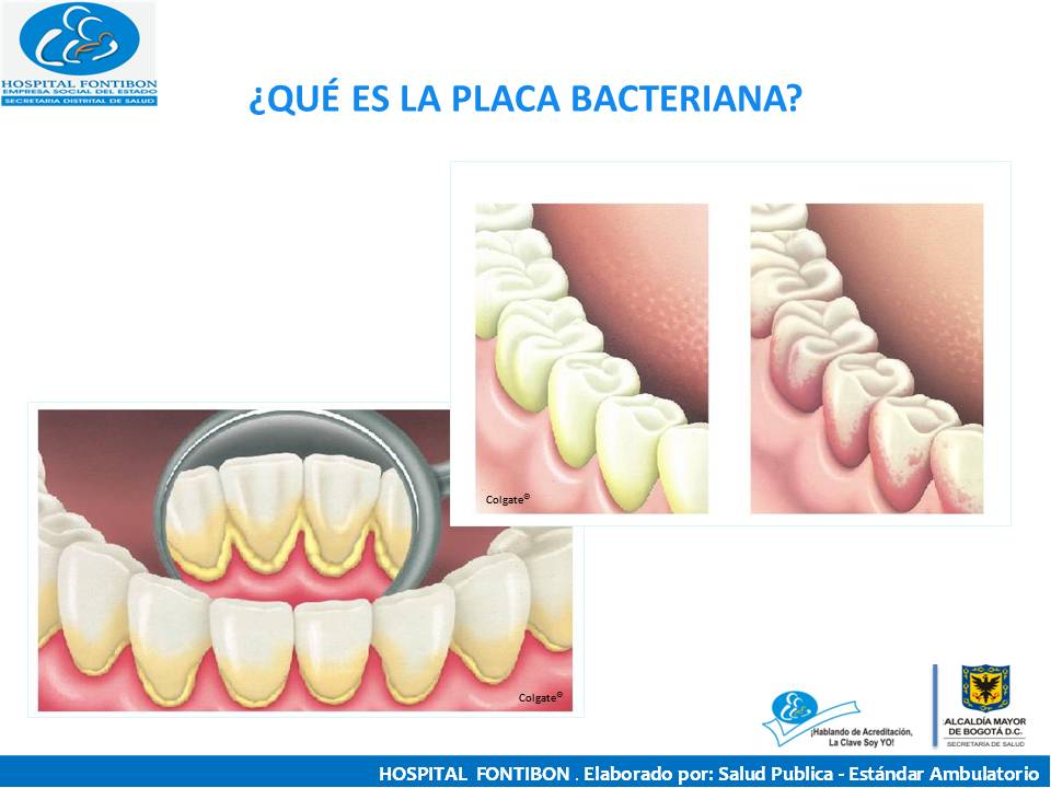 Ambito IPS: ROTAFOLIO DE SALUD ORAL