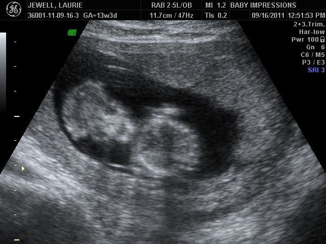 The Family Jewell: The face of Acrania