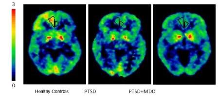 Snapshot of the pieces: Brain Scan & Hope