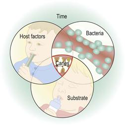 REASONS FOR VISITING DENTIST: Tooth decay... A basic understanding and ...