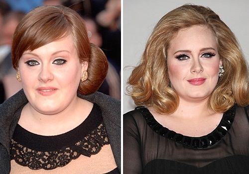 New Celebrity Height: Adele Plastic Surgery Nose