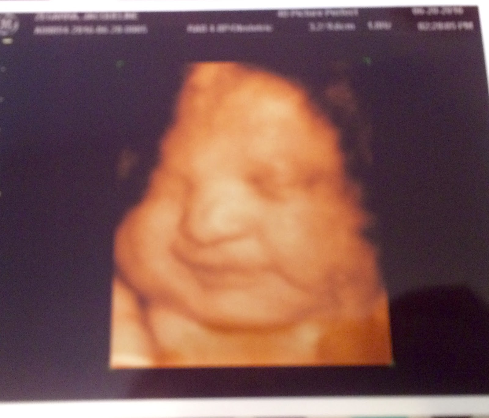 Loved You Then, Love You Still, Always Have & Always Will : 33 Weeks