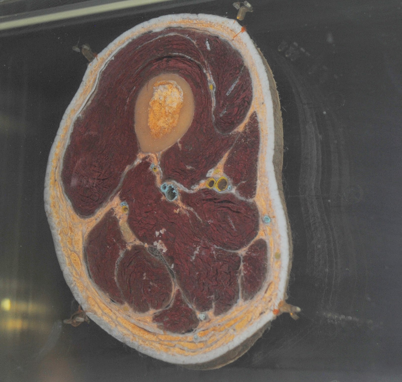 The Carpetbagger: Return of the Body Slices