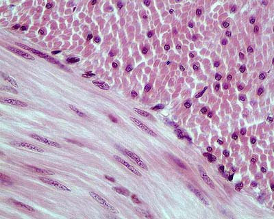 HISTOLOGIA. ULA: Formas celulares