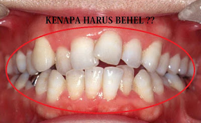 Kumpulan Berbagai Informasi