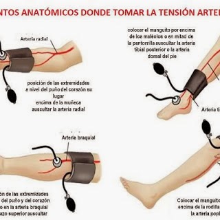 Eduardo Di Ricci: PRESION ARTERIAL TA