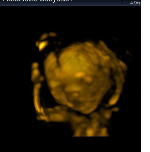 First Choice Baby Scan: 19 Weeks pregnant