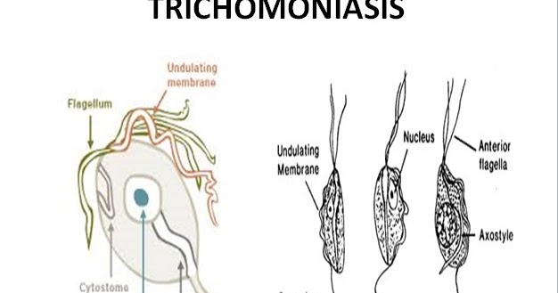 THE TRICHOMONIASIS AND MYCOPLASMA GENITALIUM SYNDROME: TREATMENT AND ...