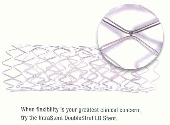 Pedi cardiology: Cath: Stents - Intrastent LD