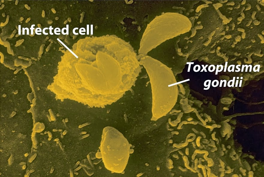 Mundo Universitário : Parasitologia Humana - Aula 01 - Toxoplasmose