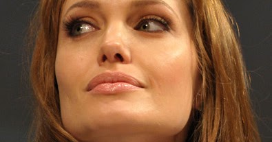 Selston Cosmetic Clinic: Botox Treatment for Square Jaw Reduction ...