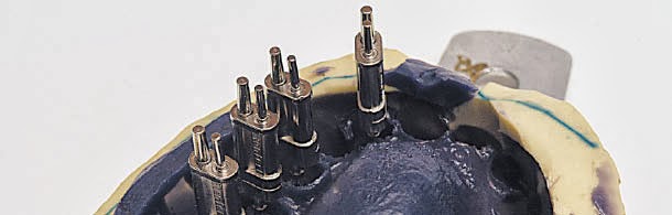 Système des Dowel-pins: C’est une tige en laitonpositionné dans l ...