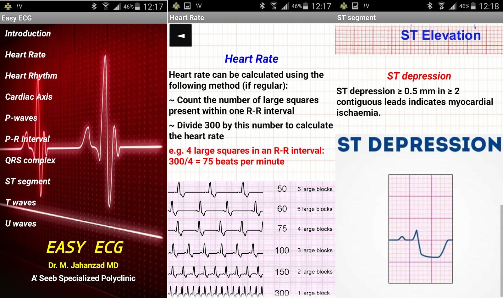 Easy ECG