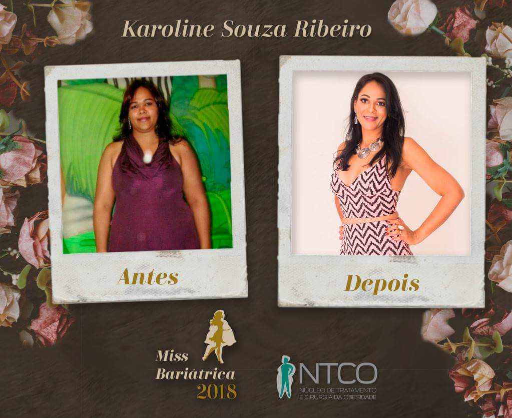 Jacobinense Karoline Ribeiro se inscreveu no Concurso Miss Bariátrica ...