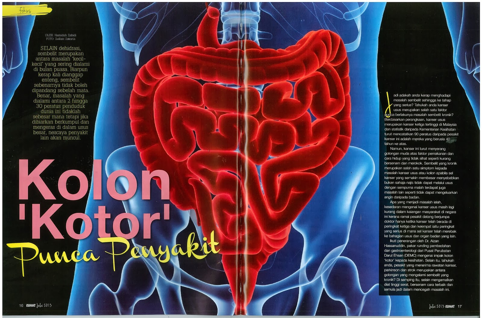 ZERO to HERO: KANSER USUS atau KOLON KOTOR PUNCA PENYAKIT