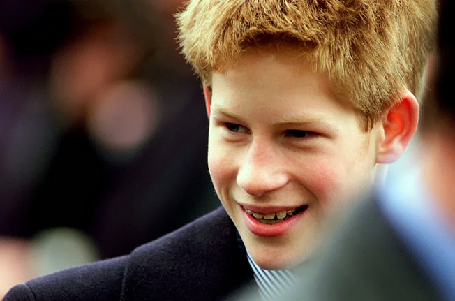 OrthoWorks: Celebrities That Used to Wear Braces